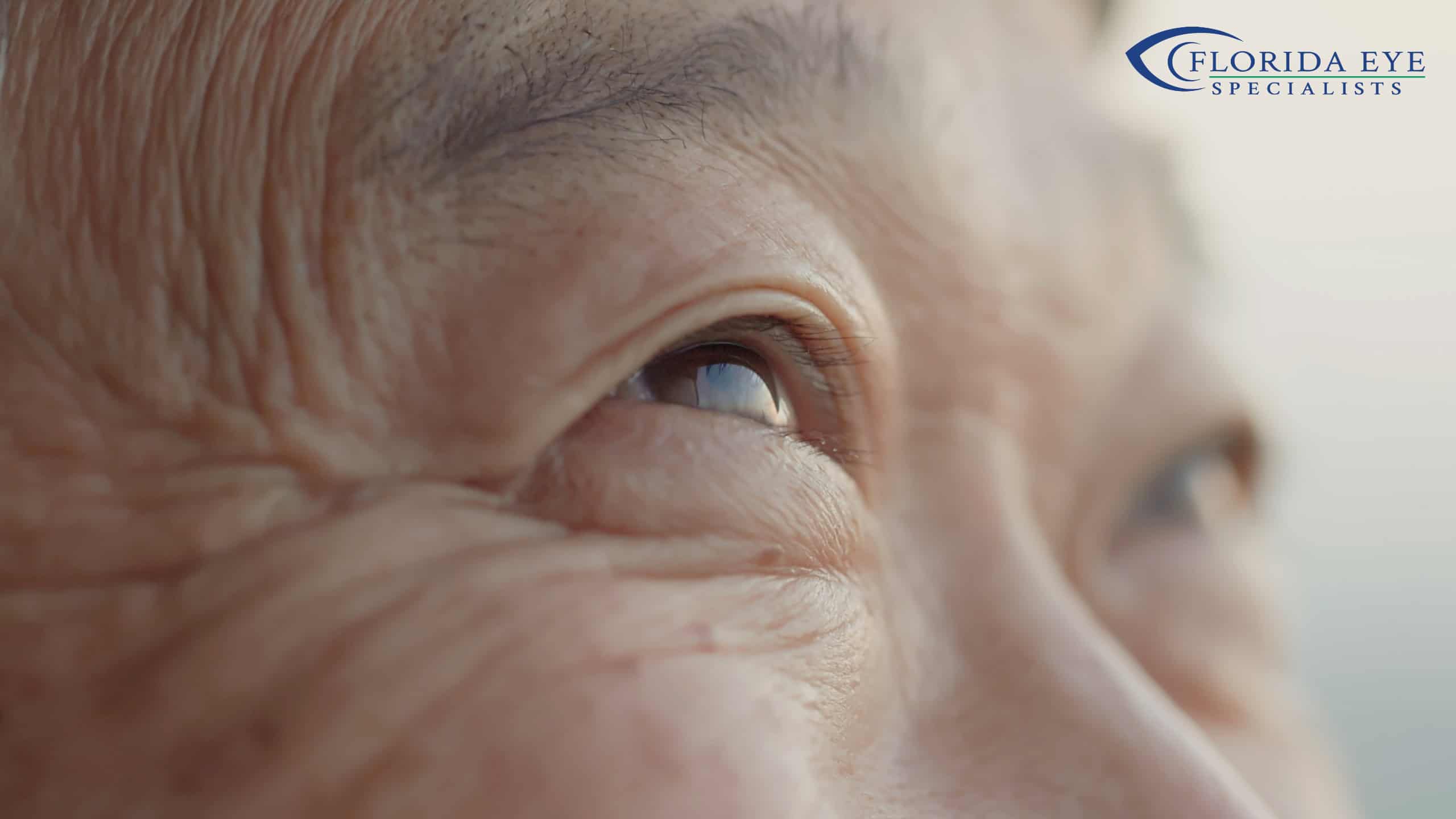 What is the First Sign of Cataracts? - Florida Eye Specialists