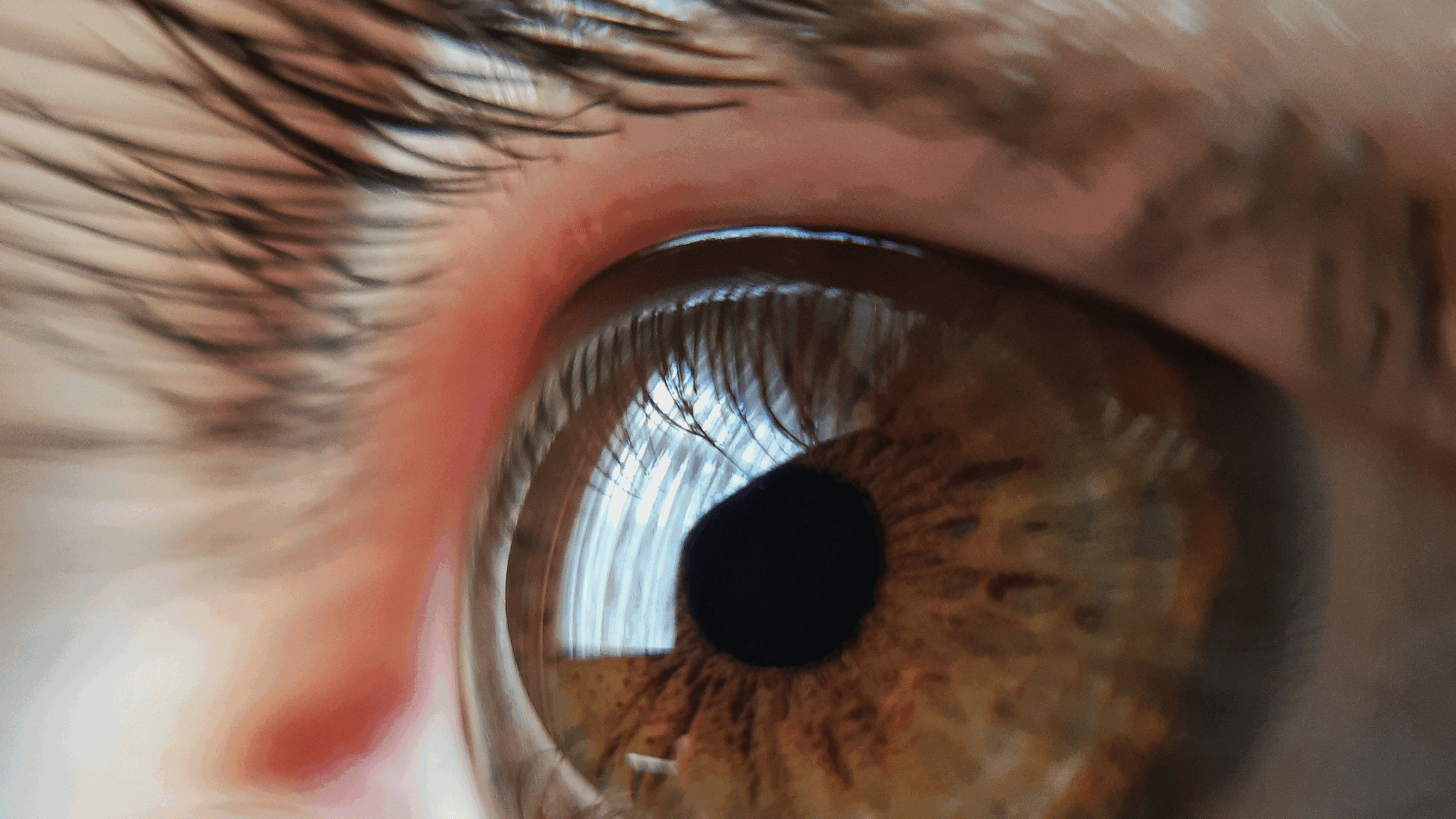 Florida Eye Specialists | Eye Care Center | Jacksonville, FL