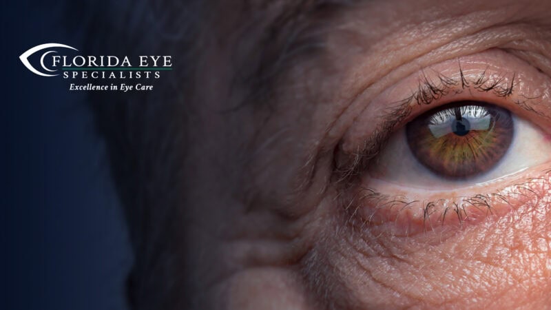 Training Eyes After Cataract Surgery - Florida Eye Specialists